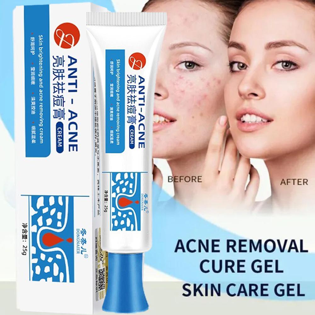 Brightening Acne Cream Facial Repair Dilute Acne Marks Pimples Care ...