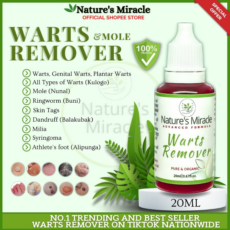 Nature s Miracle Pure & Effective Kasoy Oil 20ML for Mole Skin Tag ...