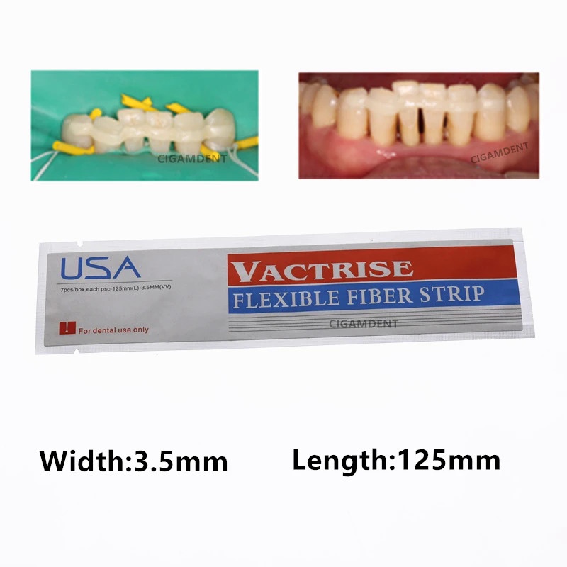 1-7Pc Dental Fiber Splint Glass Flexible Fiber Strip Composite Resin ...