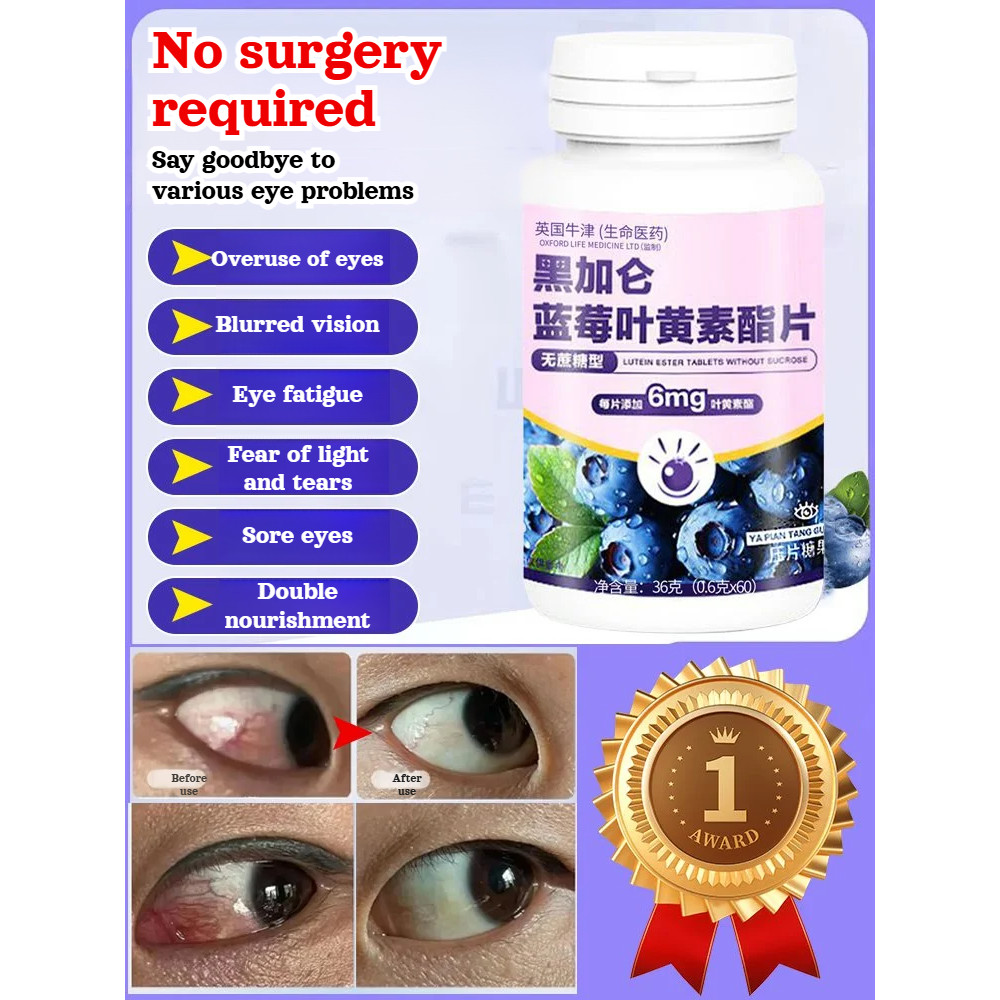 Relieve eye fatigue Lutein tablets enhancement of vision Blueberry Lutein Ester Tablet Leaf loss ...