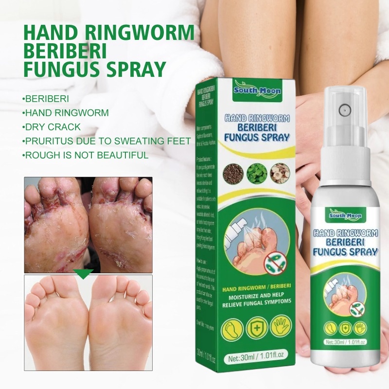 Psoriasis Eczema fungal Treatment Spray Athlete Foot Hand ringworm ...