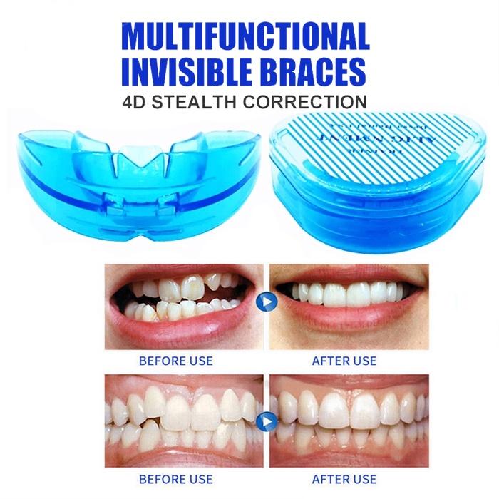 Dental Tooth Orthodontic Trainer Silicone Teeth Trainer Alignment Rapat ...