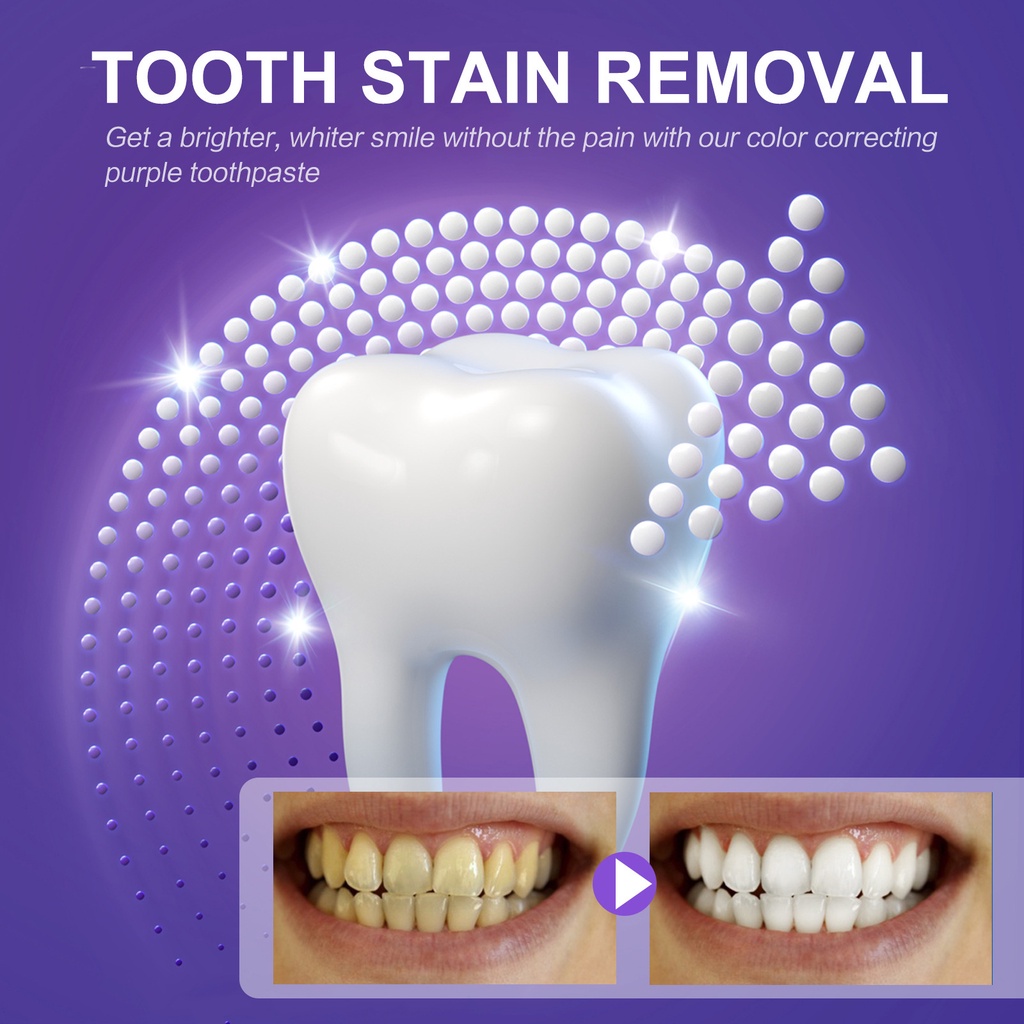 Ouhoe Purple Toothpaste V34 Teeth Color Corrector Whitening Teeth ...