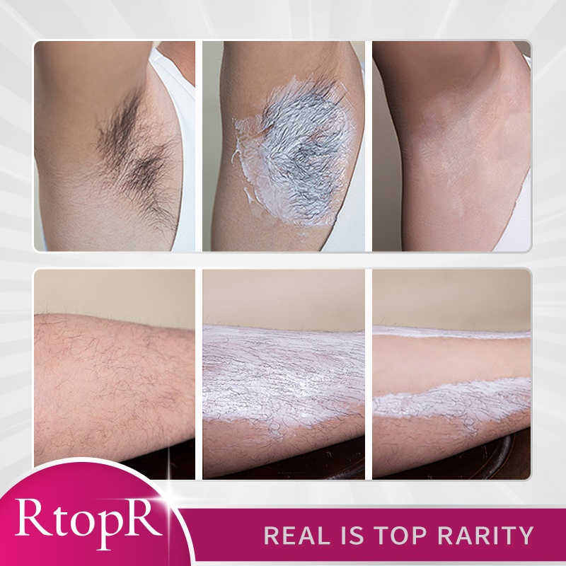 RtopR Mango Body Hair Removal Cream Painless Fast Gental Hair Removal ...