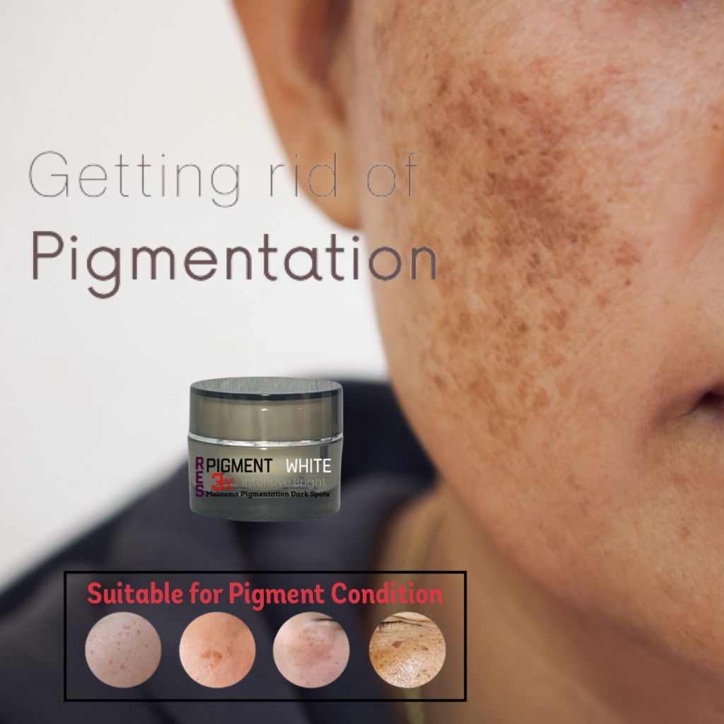 Pigment-White 3x Intensive Bright Cream (5ml / 10ml) Pigmentation ...