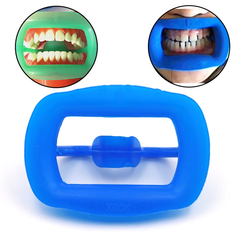 Dental Intraoral Mouth Opener 3D Cheek Lip Retractor Mouth Opening ...