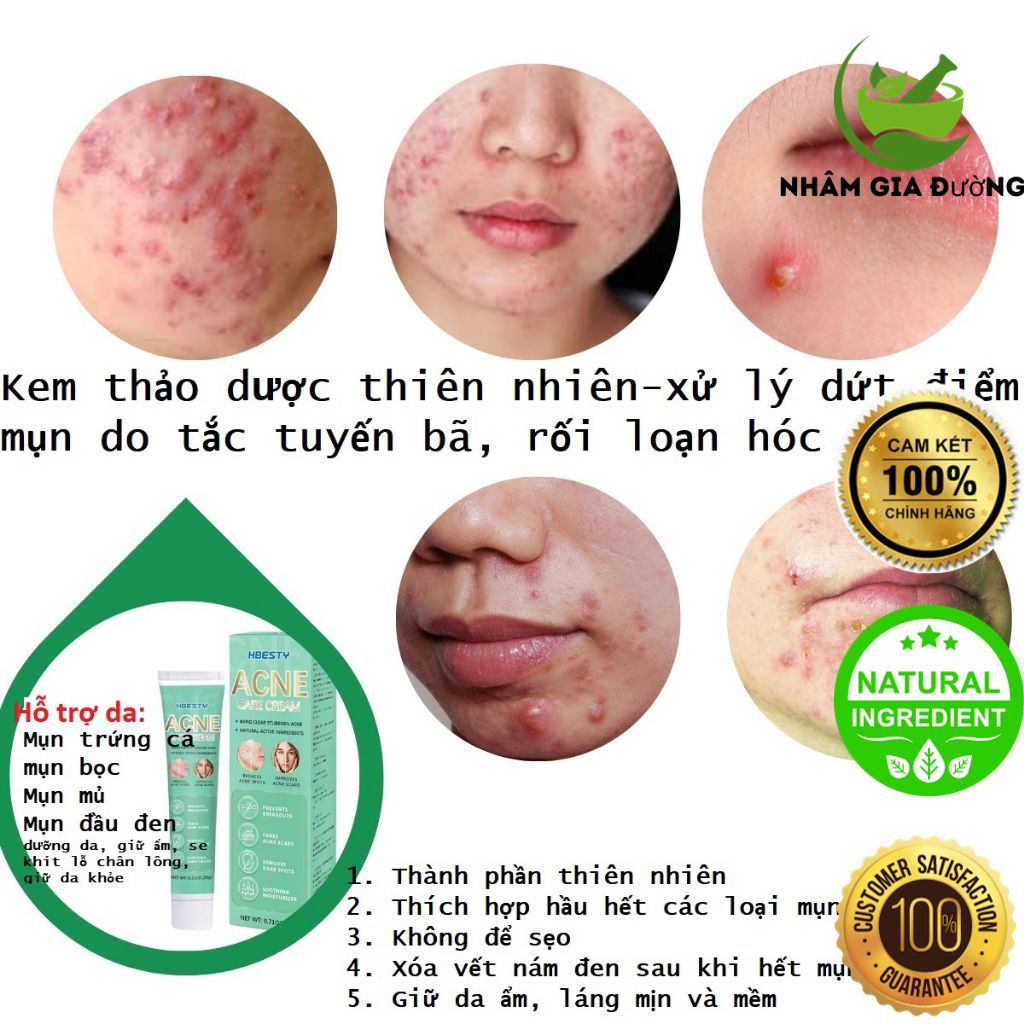 Cream for Acne, Red Acne, Blackheads, Pustules... 100% herbal ...