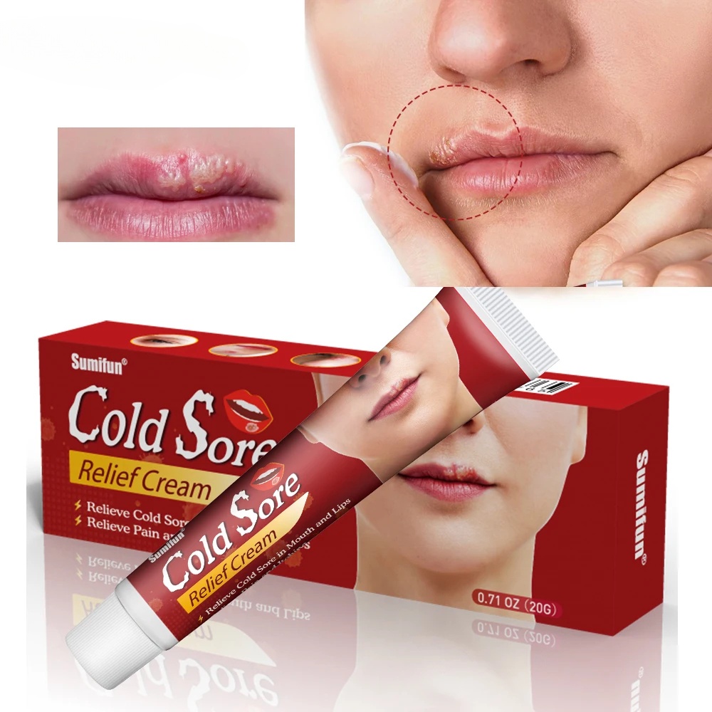Cold Sores Lip Cheilitis Treatment Cream Herpes Antibacterial Ointment Chapped Lips Wrinkles ...
