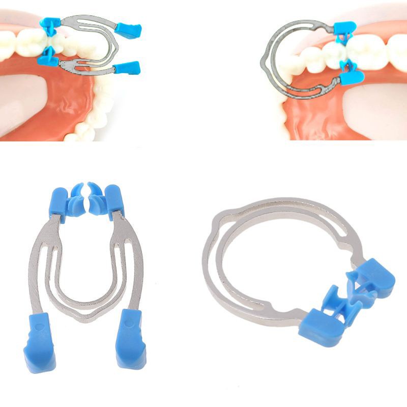 Dental Sectional Contoured Metal Spring Clip Teeth Replacement Dental ...