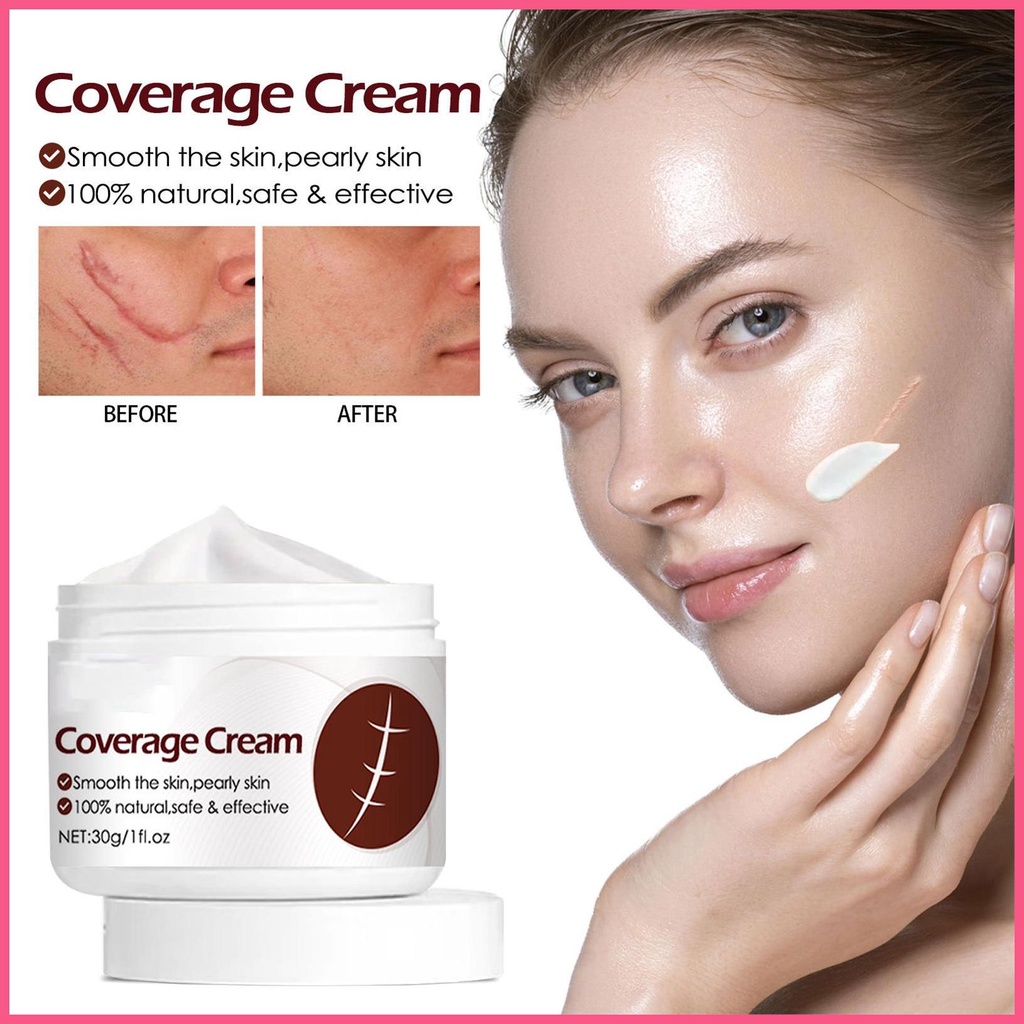 Scar Removal Cream 30g Effective Anti Scarring Cream Portable Scar Gel ...