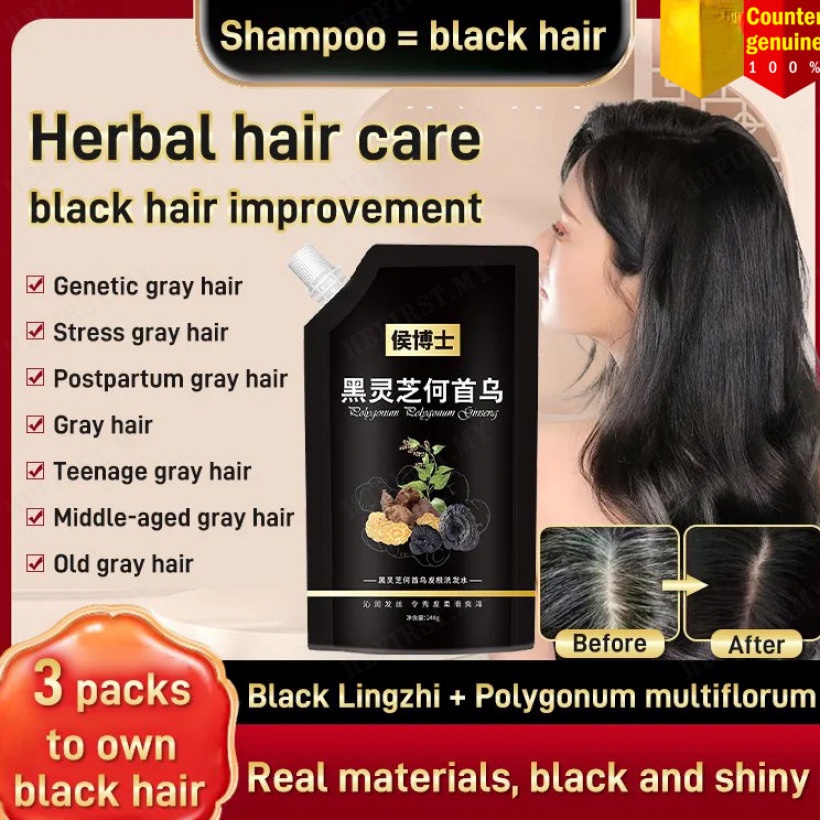 【Ready Stock】Anti-itch oil control anti-dandruff shampoo Black ...