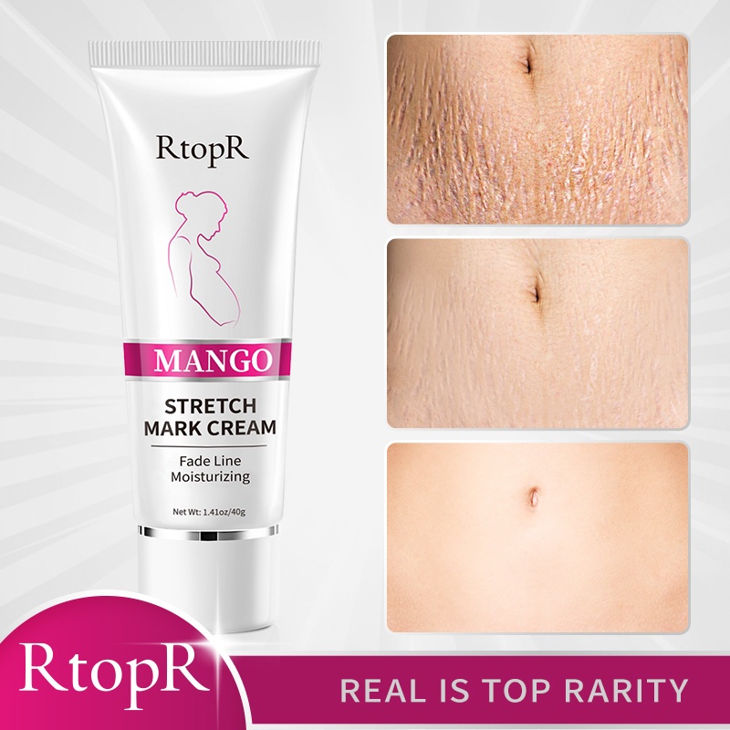 RtopR Mango Stretch Mark Cream Anti-Winkles Firming Body Maternity ...