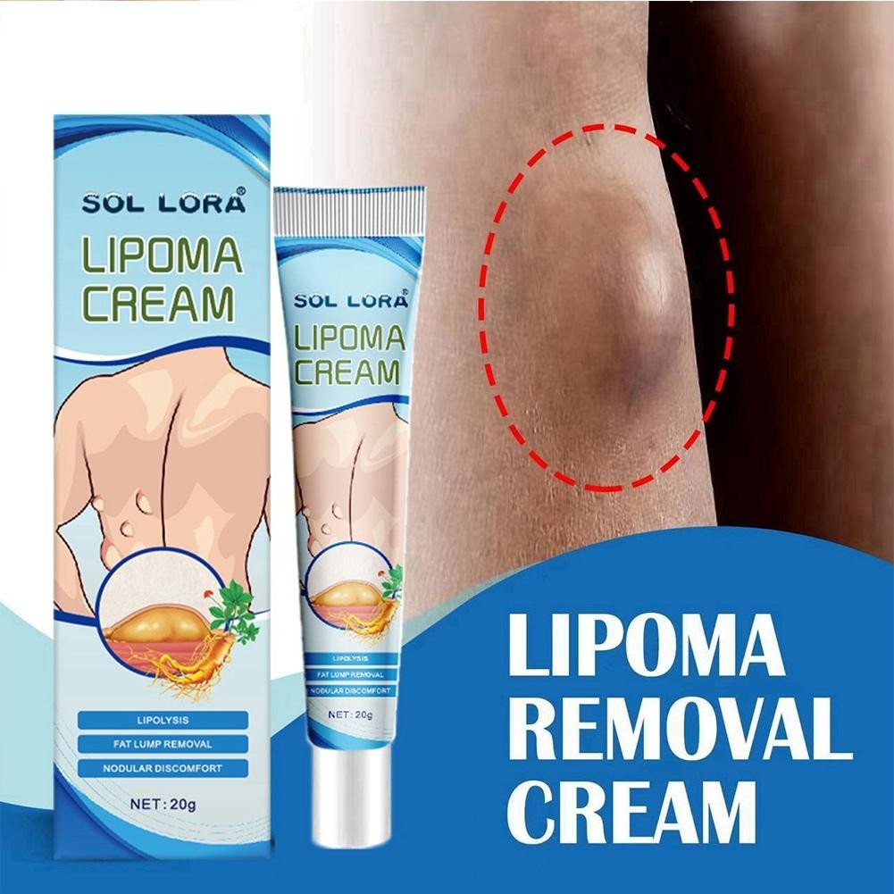 Lipoma Removal Cream Lipolysis Fat Lump Relief Plaster Skin Swelling ...