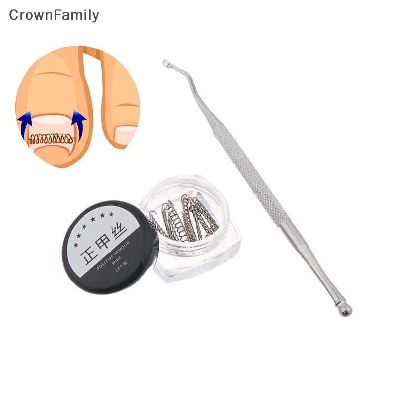 [CrownFamily] Ingrown Toe Nail Correction Wire Fixer Pedicure ...