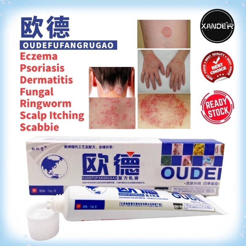OUDE欧德Eczema Psoriasis Scalp Itching Skin Dermatitis Fungal 15g Cream ...
