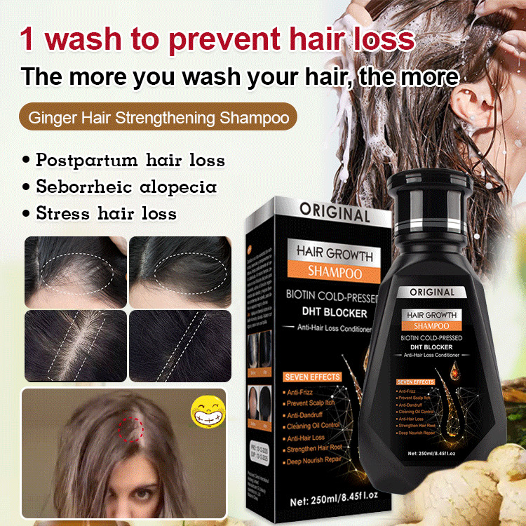 【Ship in 24H】Ginger Hair Strengthening Shampoo/Anti Hair Loss Shampoo ...