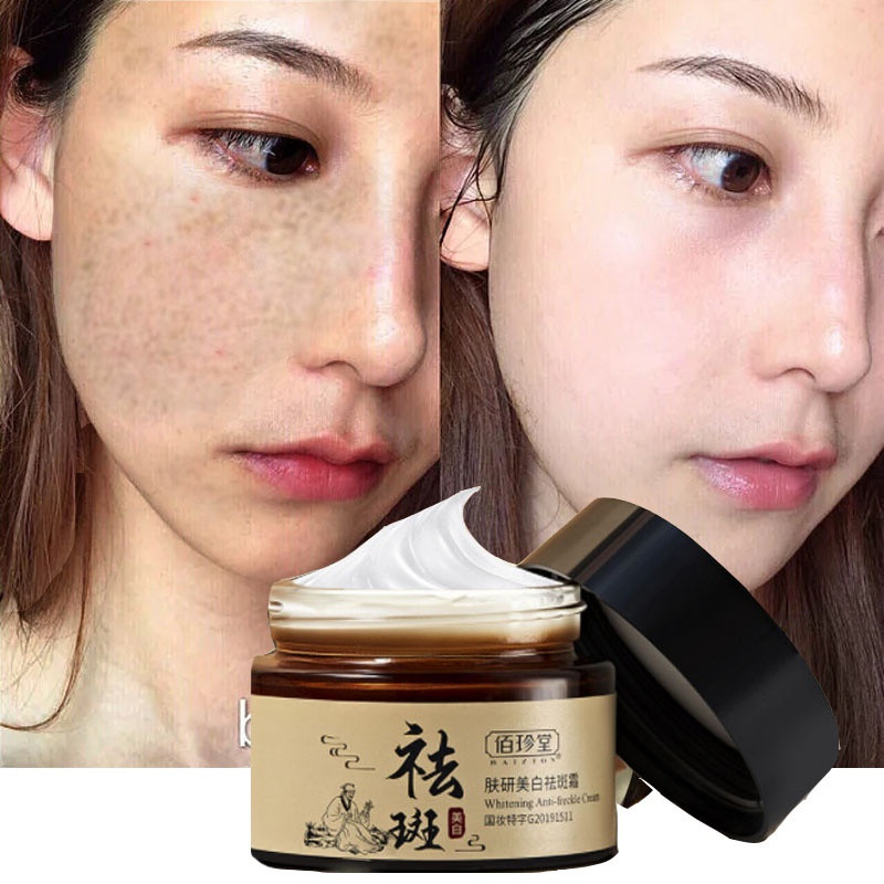 Anti-freckle cream Melasma Cream Pekas Remover Collagen Japan Pekas ...