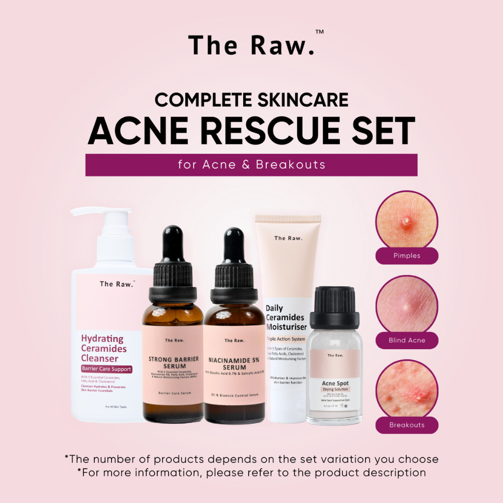 The Raw. Acne Rescue Set - for Acne & Breakouts | Shopee Malaysia