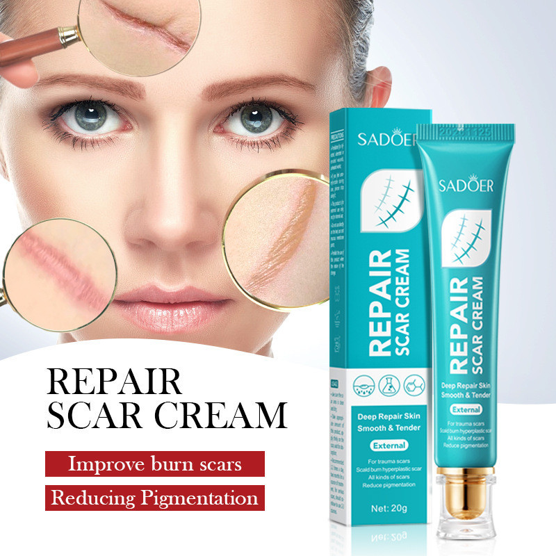 SADOER Scar Repair Cream for Repair Acne Scars Improve Burn Scars 20g ...
