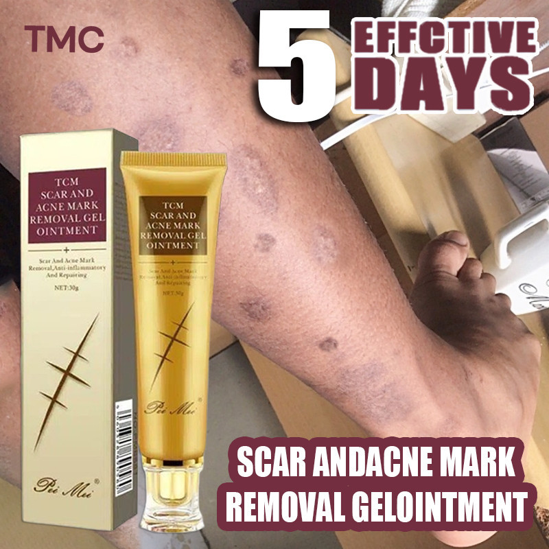 HITAM Tcm Scar Andacne Mark Removal Gelointment Ointment Black Scar ...