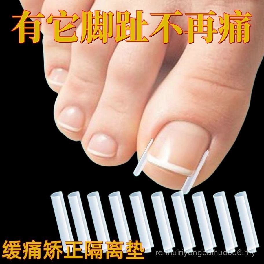 Paronychia Correction Handy Tool Nail Corrector Ingrown Nails Dedicated ...