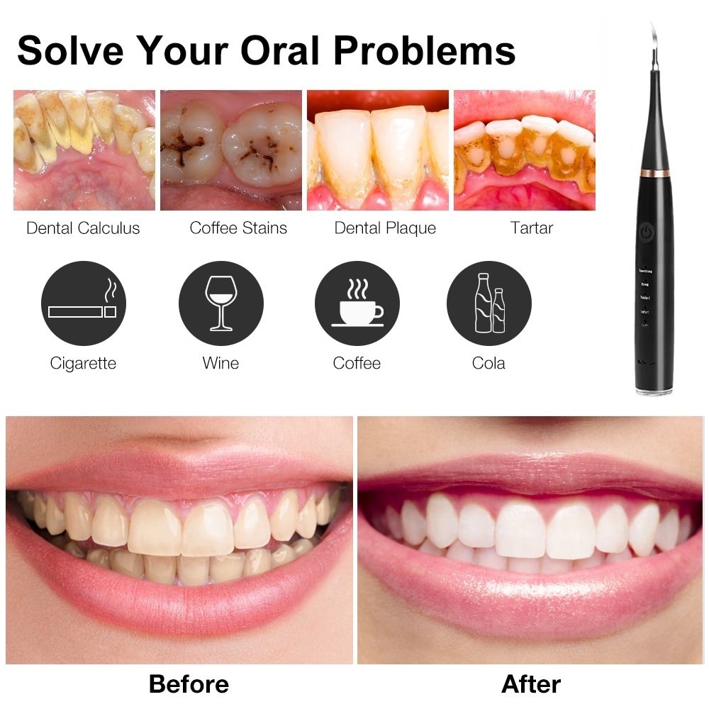 Electric Oral Irrigator Dental Scaler Tooth Cleaning Kit Calculus ...