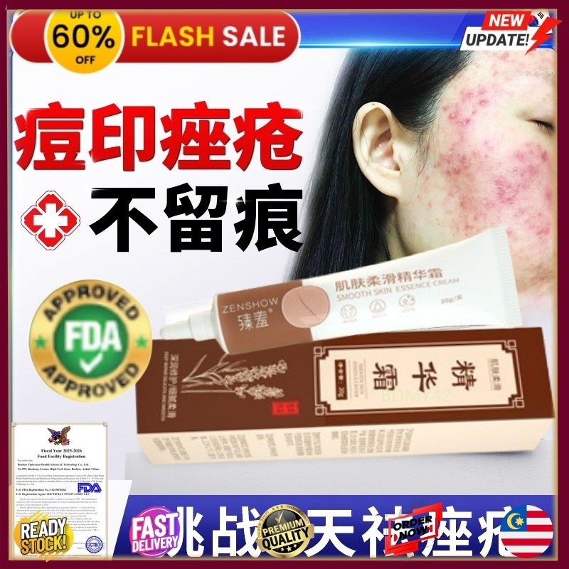 Krim Hilangkan Parut Hitam Menghilangkan Bekas Luka Lama Scar Removal ...