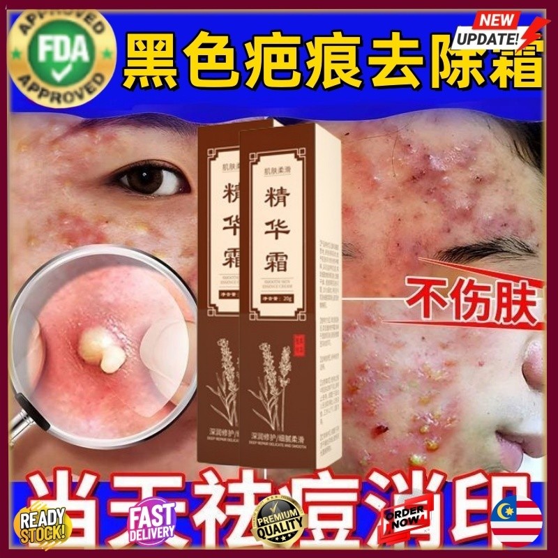 Effective Scar Removal Cream for Old Acne Treatment Skin Repair Removes ...