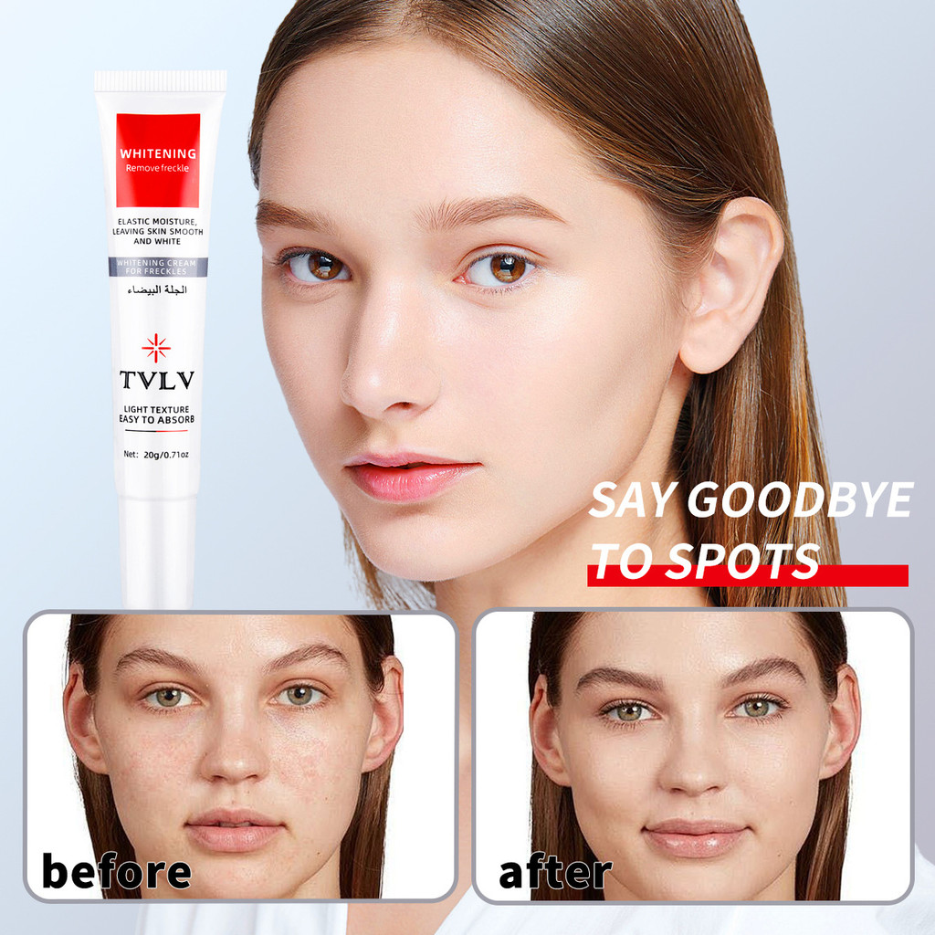 TVLV Whitening Remove Freckle Cream Niacinamide Brighten Lightens Dark ...
