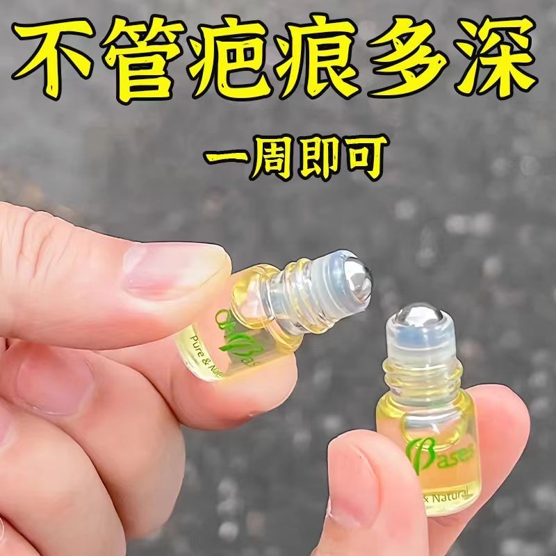 [Praise Rate Super 98% Same Style] Scars Scratches Scalds Growth Scars ...