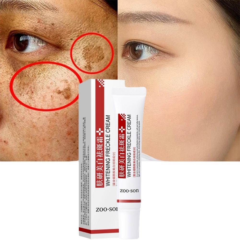 Spot Light Cream Bright Skin Oil Control Moisturizing Moisturizing Acne ...