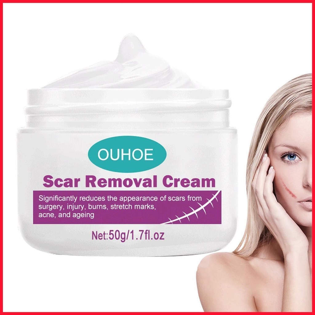 Surgical Scar Removal Cream Burn Repair Balm for Face and Body Scar ...