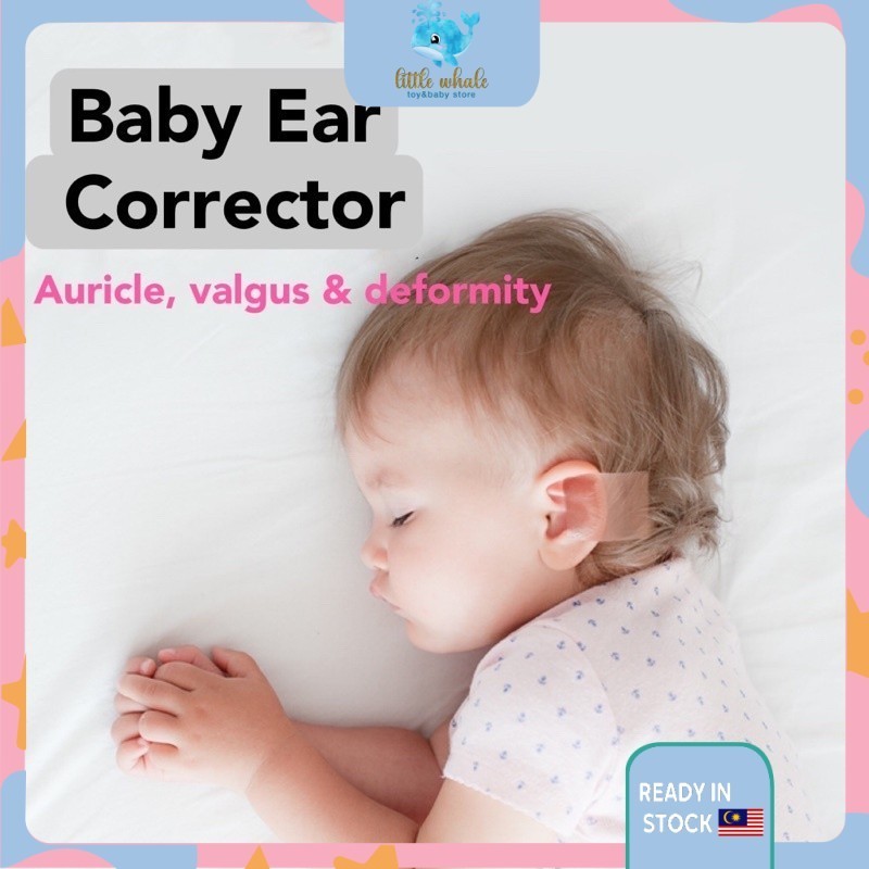 🐳Infant Baby Aesthetic Cosmetic Ear Correctors for Protruding Ears ...