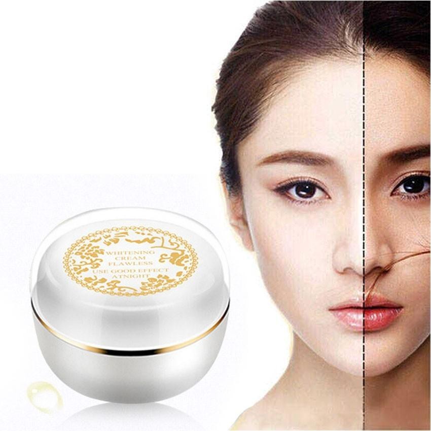 Lady Skin Cream Magic Glow Freckle Removal Whitening Cream Freckles ...