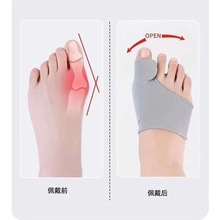 Correcting protruding large foot bones with toe corrector, dividing ...