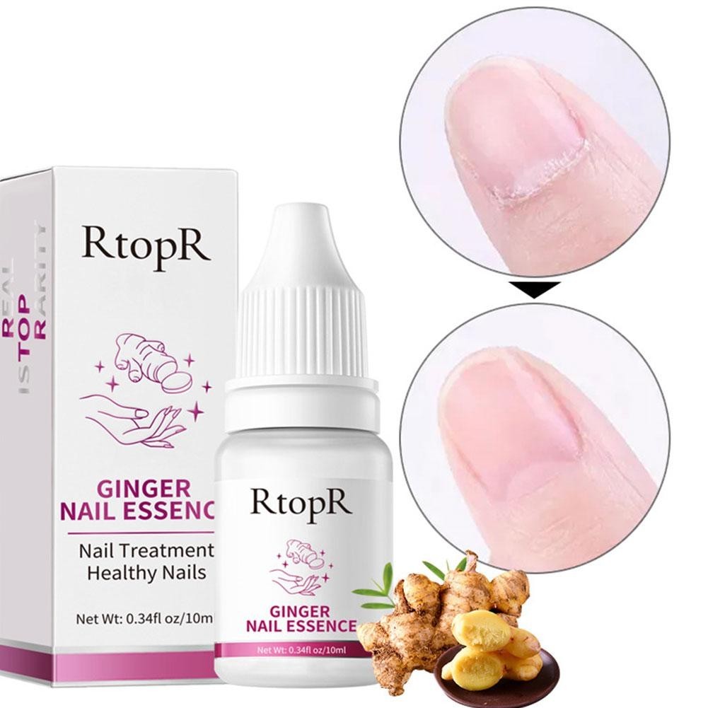 RtopR Ginger Nail Essence Anti Infection Paronychia Nail Treatment ...