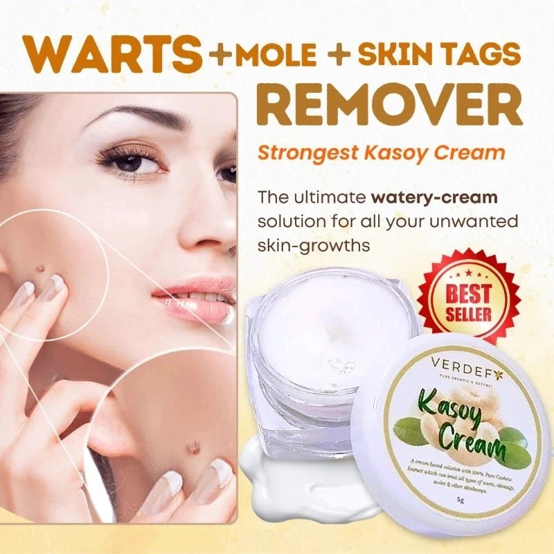 5/50g ORIGINAL STRONG KASOY CREAM EFFECTIVE REMOVER OF WARTS MOLE SKIN ...
