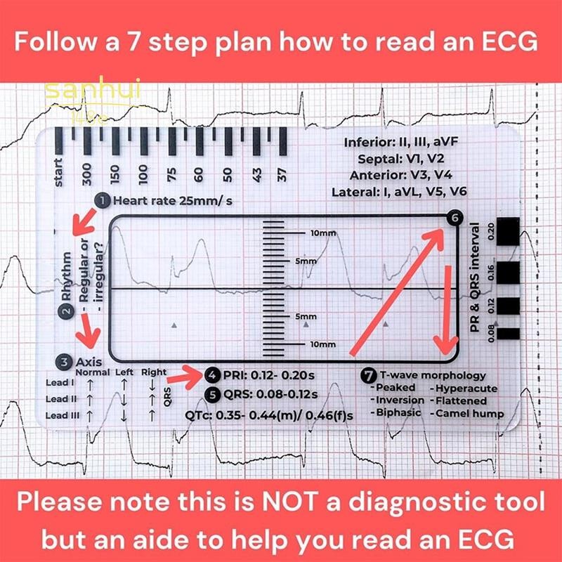 ECG 7 Step Ruler, ECG 7 Step Ruler for ECG/EKG Interpretation, Rapid ...