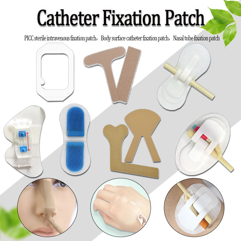 PICC Catheter Placement Plaque Venous Surface Catheter Nasal Tube ...