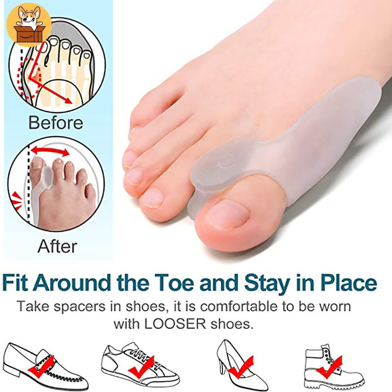 【Am-az】2pcs Hallux Valgus Corrector Pad Silicone Finger Toe Separator ...