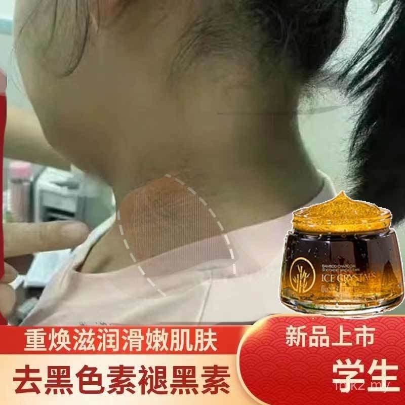 Neck Armpit Joint Remove Black Knees Finger Face Buttocks Black Skin ...