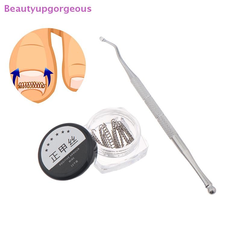 Beautyupgorgeous Ingrown Toe Nail Correction Wire Fixer Pedicure ...
