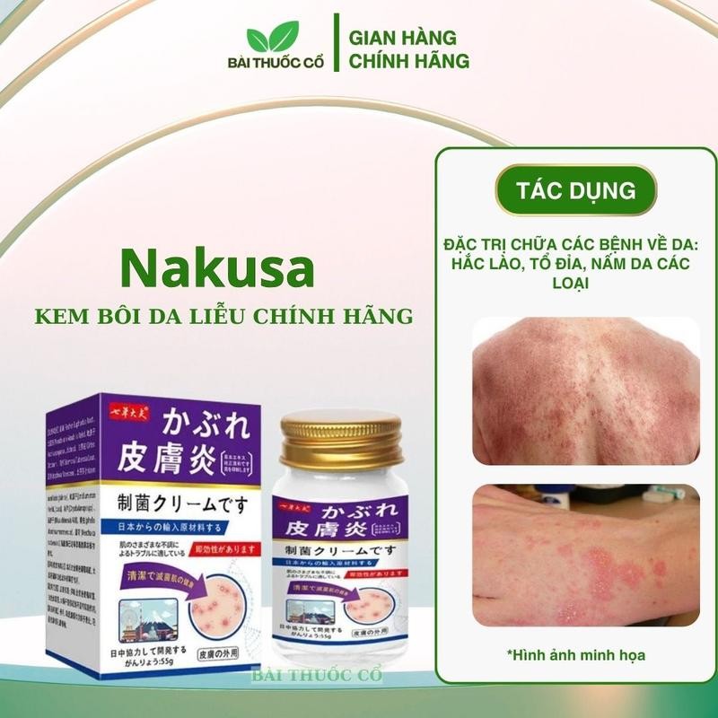 [Genuine] Nakusa Dermatological Cream Ringworm Psoriasis Asian ...
