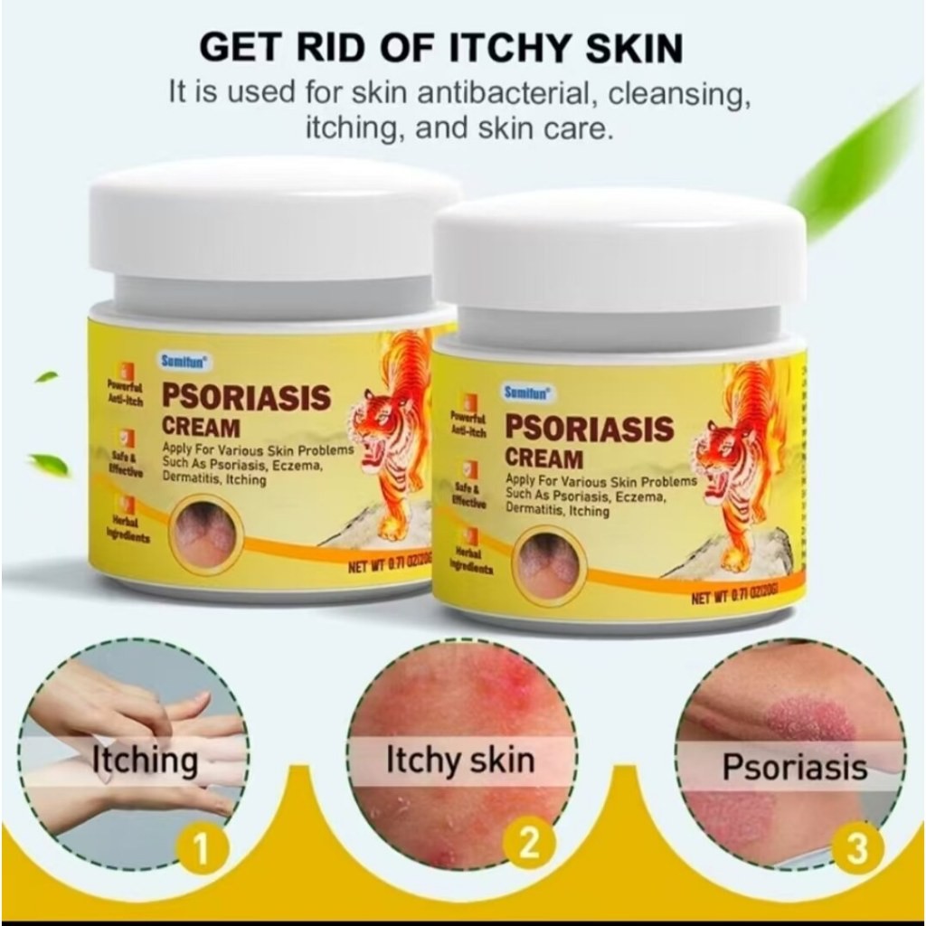 Psoriasis Cream Antifungal cream ubat gatal kulit tiger balm Itchy Skin ...