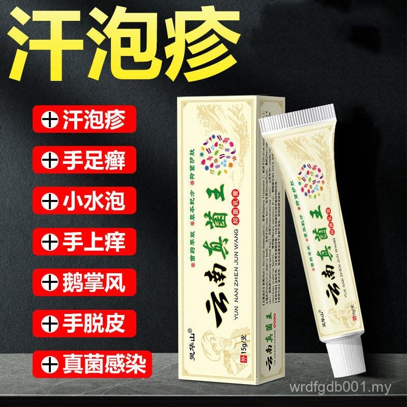 Shopee Shopee Official Yunnan Fungus King Hand Foot Ups Fungus ...