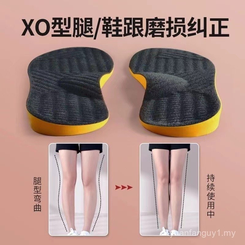 [Hot Sale] Adult o-Shaped Leg Calf Valgus Correction Insole Straight ...