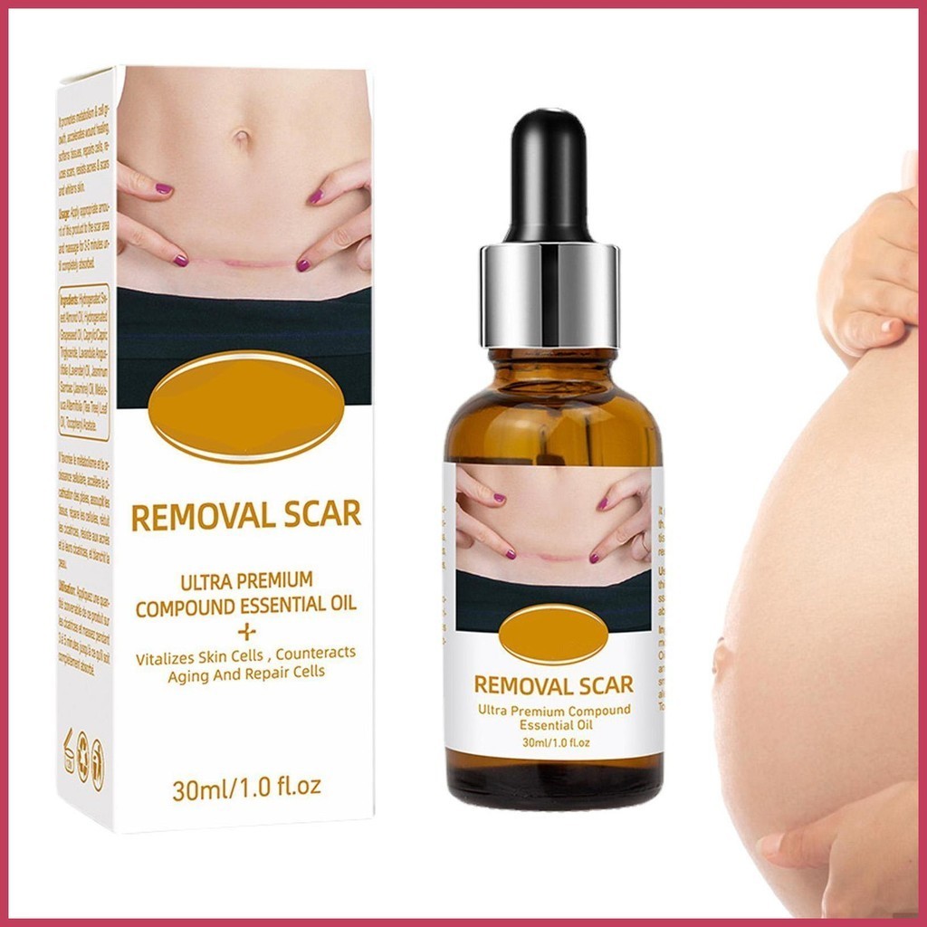 Scar Oil Body Face Tissue Oil for Scars & Stretchmarks Effective ...