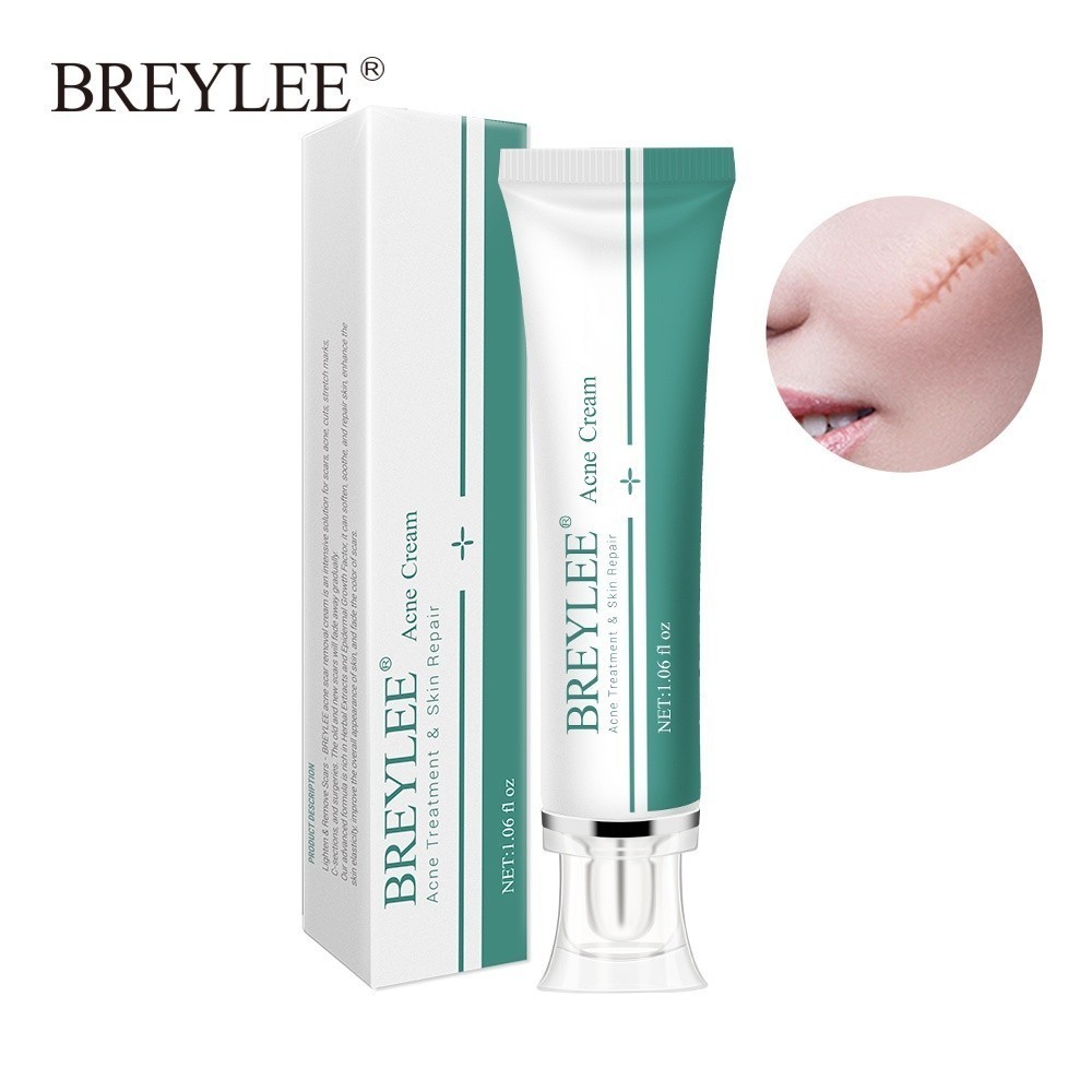 BREYLEE Scar Removal Cream Treatment Remove Stretch Marks Whitening Cream (30g) | Shopee Malaysia