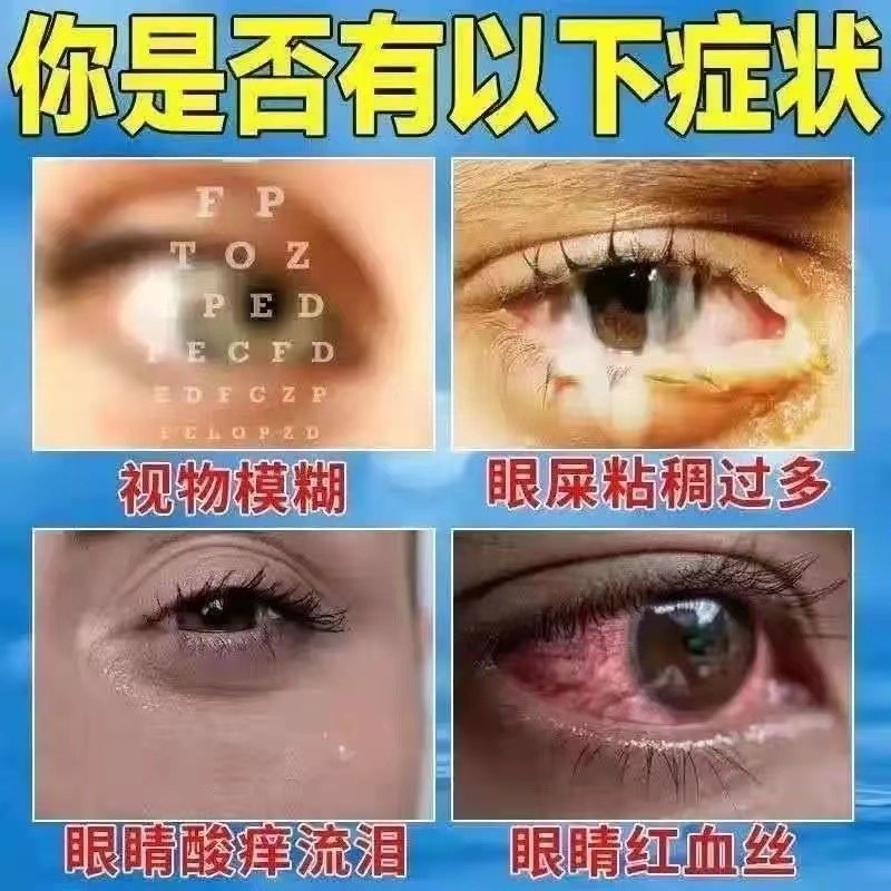 Anti-inflammatory Eye Potion Red Blood Silk Eye Wax Multi-Sterilization ...