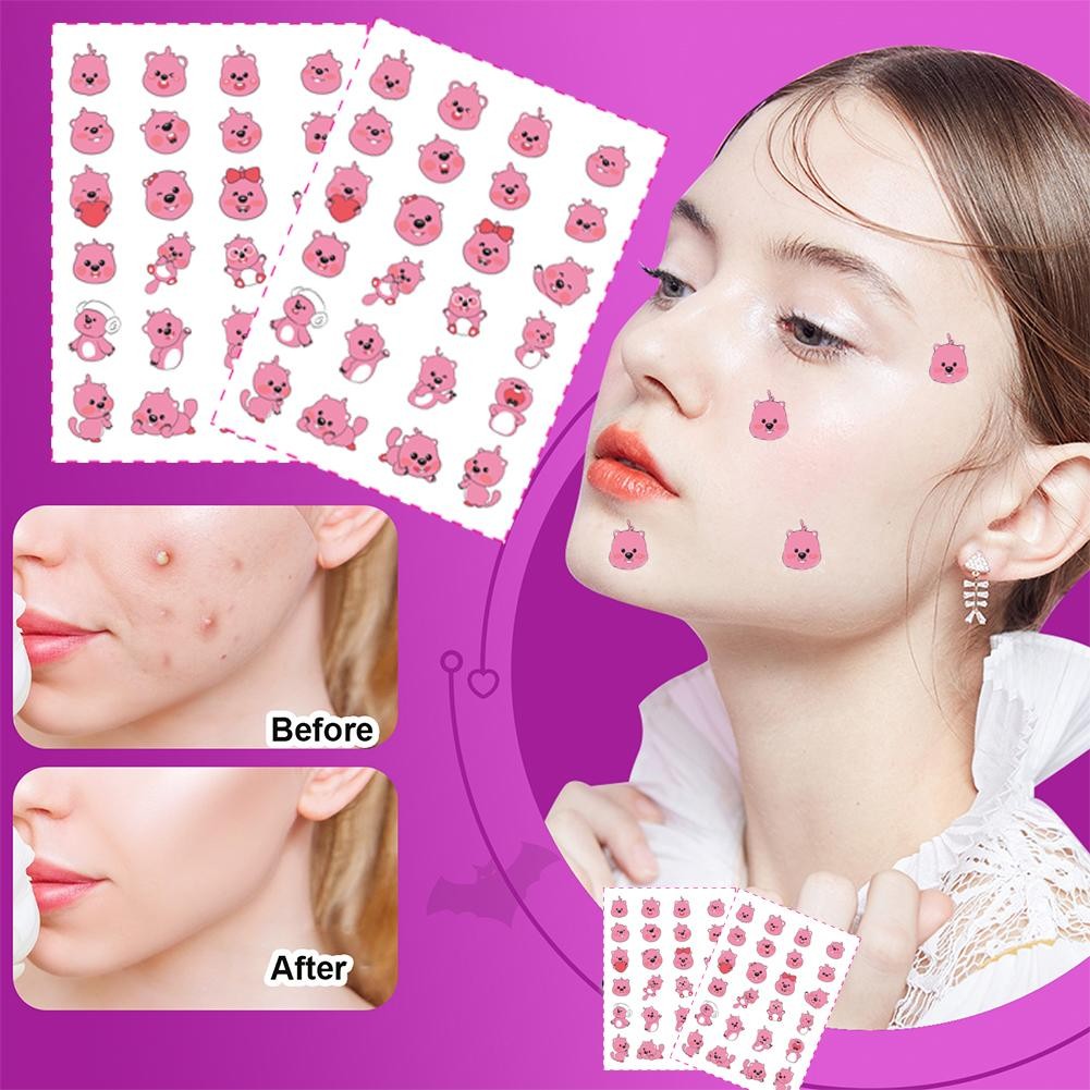 STAR Sheet Cute Loopy Acne Care Hydrocolloid Pink Patch Pimples Acne ...